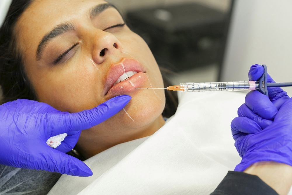 Dermal Fillers Supplier Maylips Offers Top-Quality Products Worldwide
